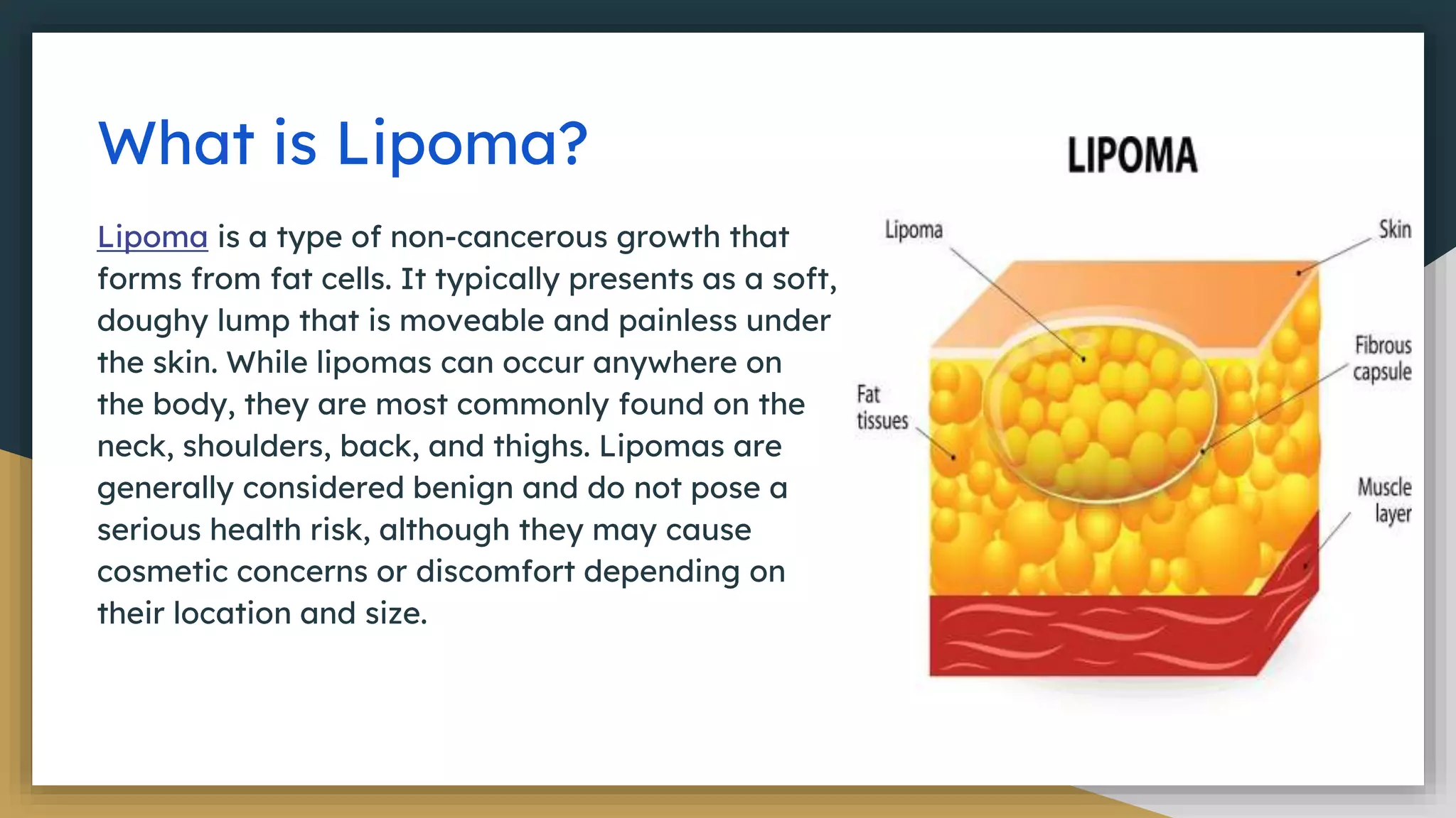 What is Lipoma , Causes , Symptoms & Treatment.pptx
