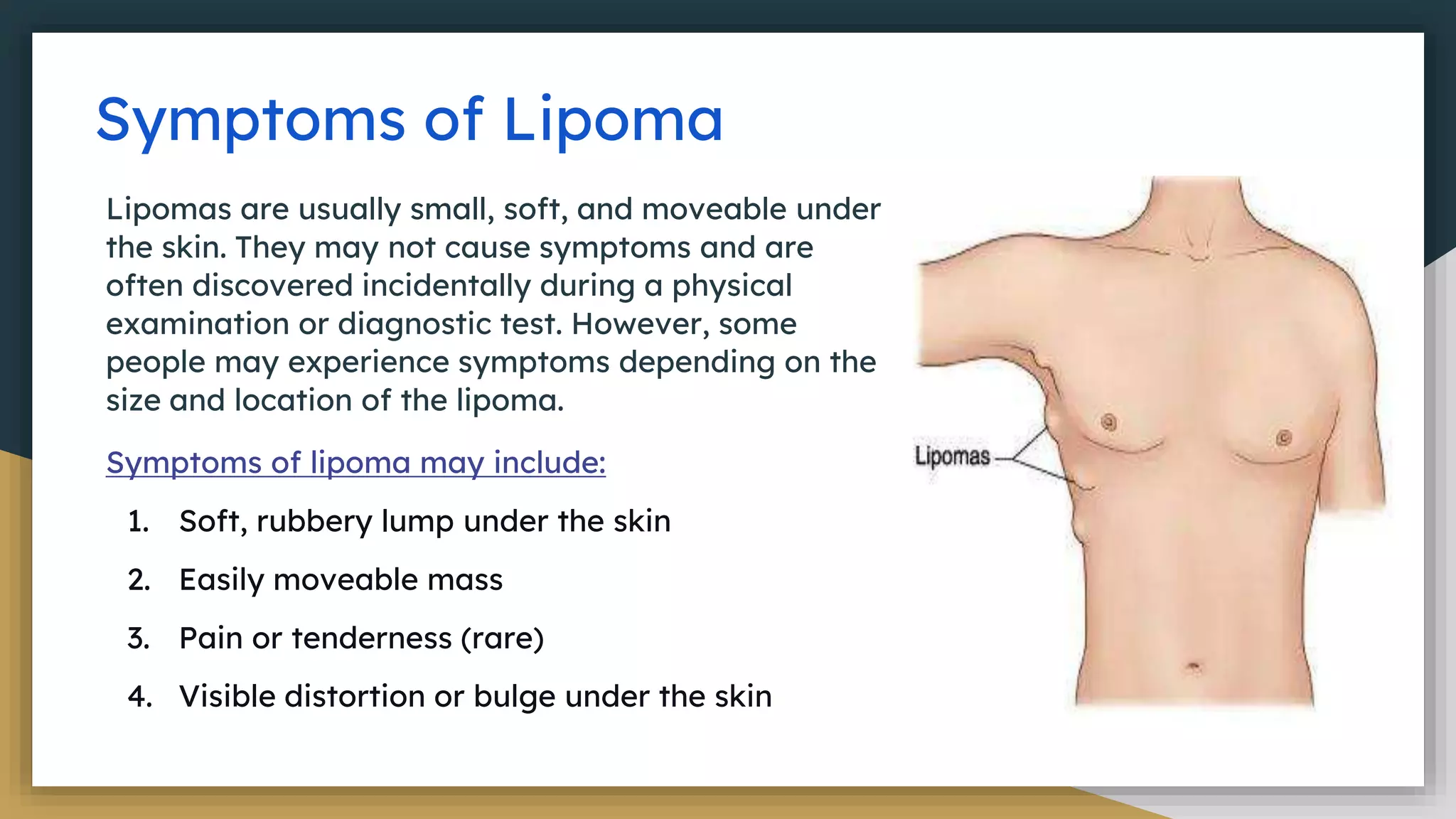 What is Lipoma , Causes , Symptoms & Treatment.pptx