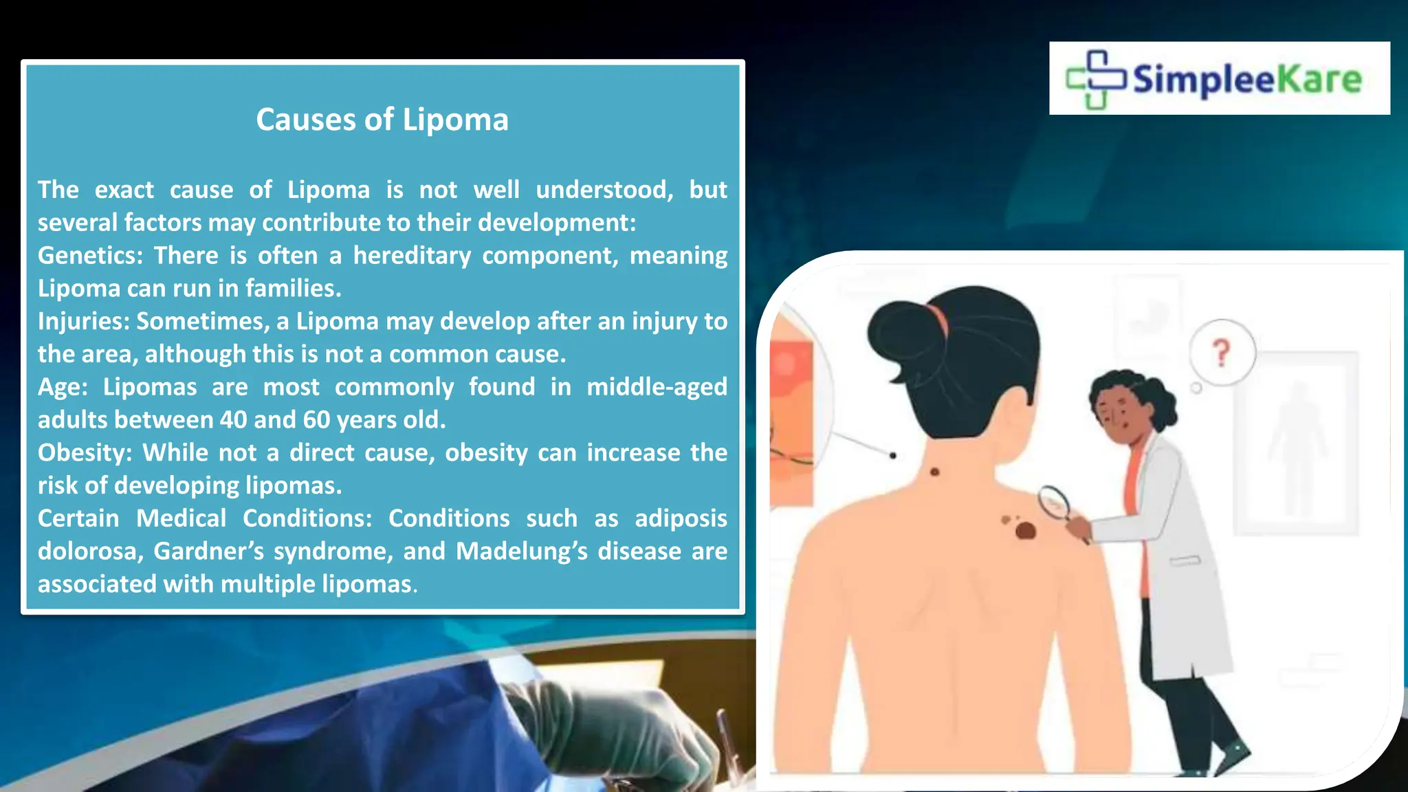 What Is Lipoma Know Its Causes, Symptoms And Treatment.pptx