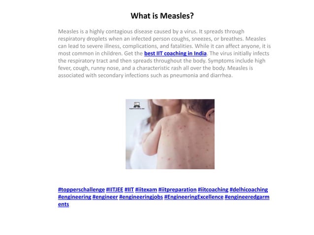 What is Measles.pptx
