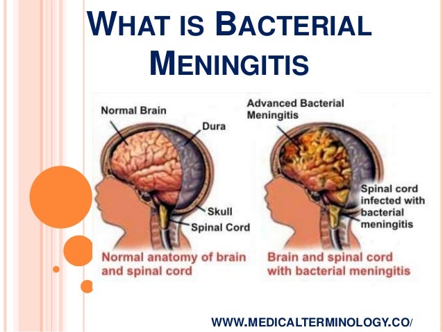 What is meningitis