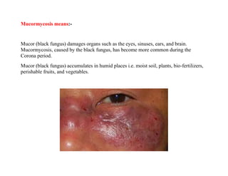 What is mucormycosis | PPT