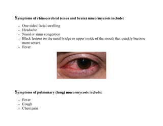 What is mucormycosis | PPT