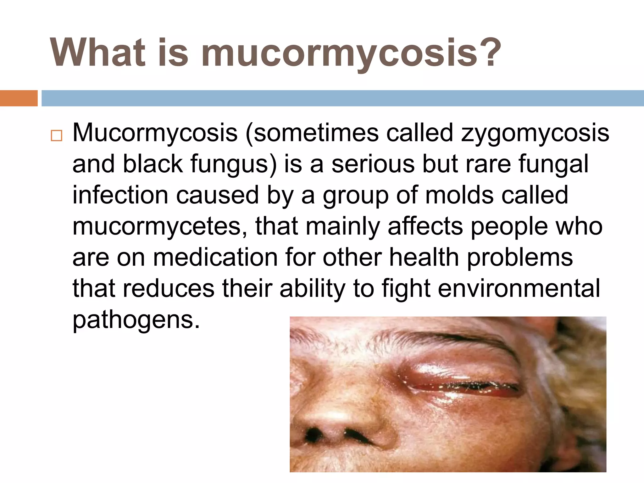 Mucormycosis | PPT
