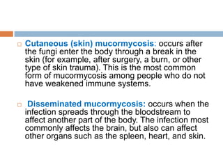 Mucormycosis | PPT
