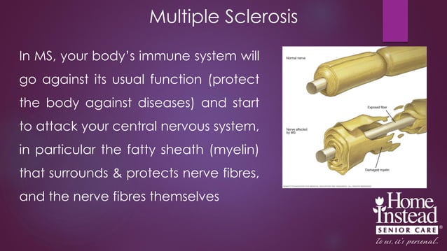 What is Multiple Sclerosis? | PPT