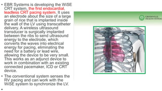 What is New in Electrophysiology Technologies-Samir Rafla.pptx