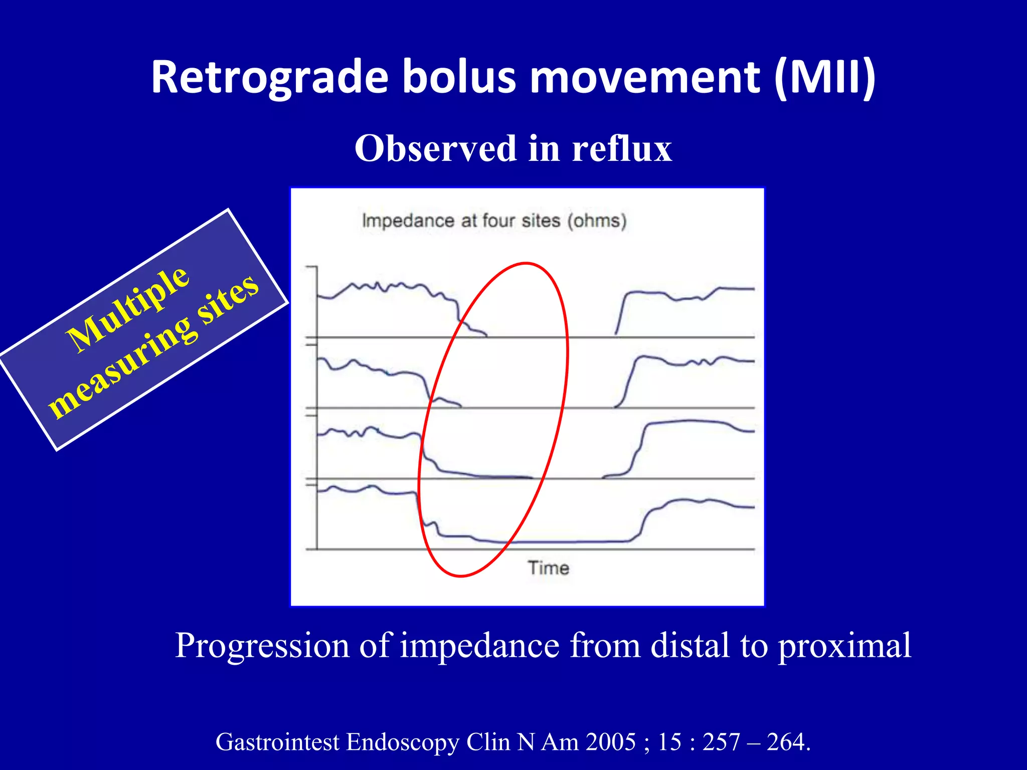 What is new in GERD investigation? | PPTX