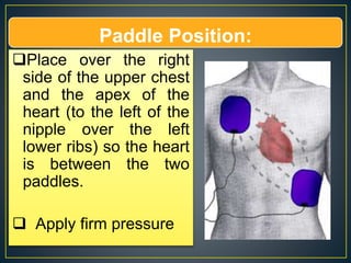 What is new in pediatric cpr | PPT