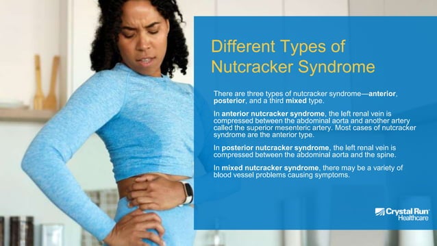 What is Nutcracker Syndrome? | PPTX