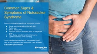 What is Nutcracker Syndrome? | PPTX