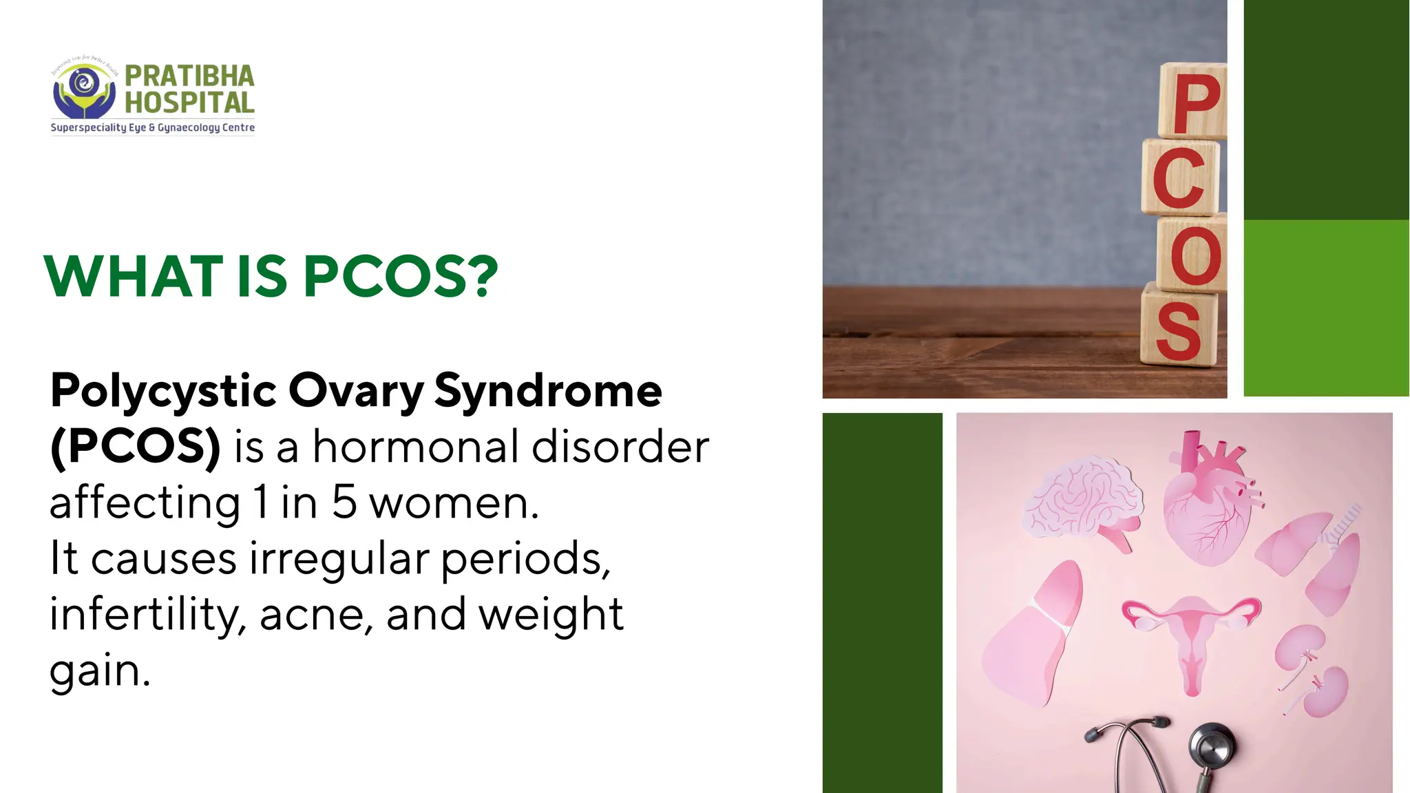 What is PCOS: Symptoms, Diagnosis, and Treatment Options | PDF