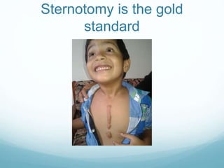 What is Pediatric Cardiac Surgery? | PPTX