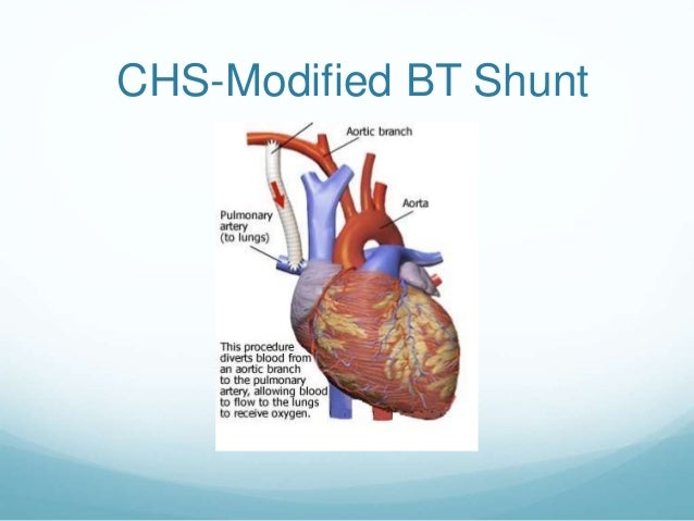 What is Pediatric Cardiac Surgery?