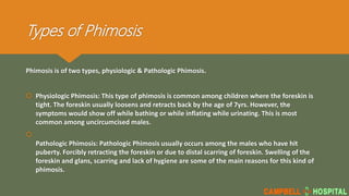 What is Phimosis? Know more about it | PPTX