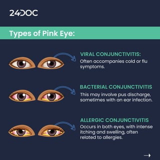 what is pink eye | PDF