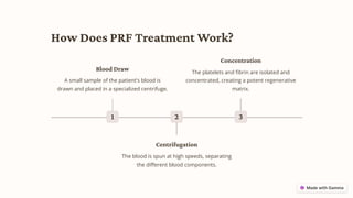 What is PRF Treatment and Why use for, Complete Guide | PPT