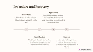 What is PRF Treatment and Why use for, Complete Guide | PPT
