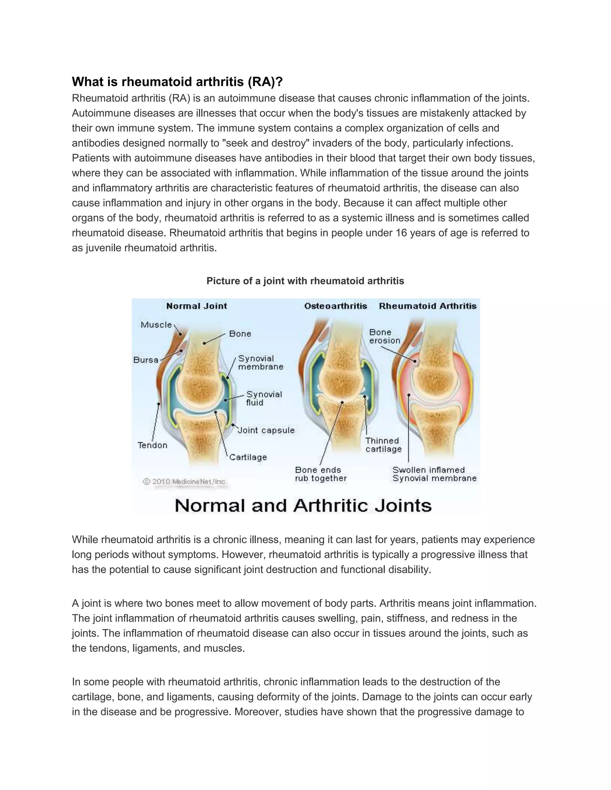 What is rheumatoid arthritis | DOCX | Bone and Joint Conditions ...
