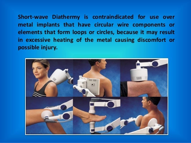 What Is Short Wave Diathermy?