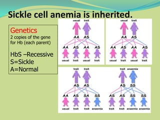 What is sickle cell anemia | PPTX