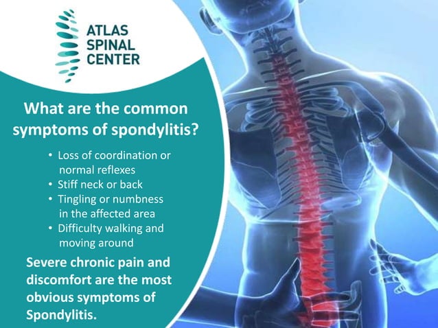 What is spondylitis | PPSX | Bone and Joint Conditions | Diseases and ...