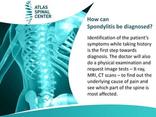 What is spondylitis | PPSX