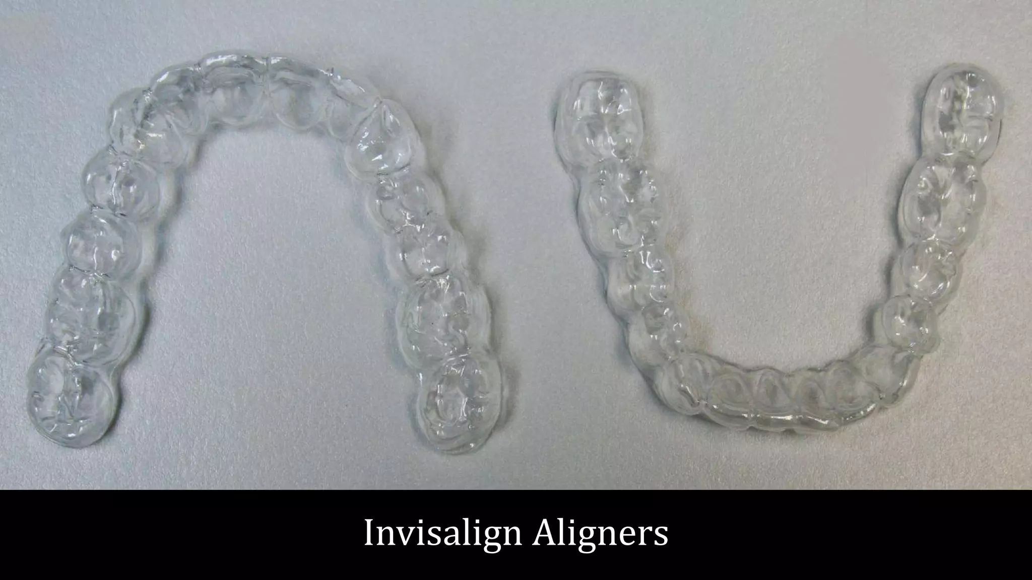 What is teeth spacing? – Its causes and cures | PPTX