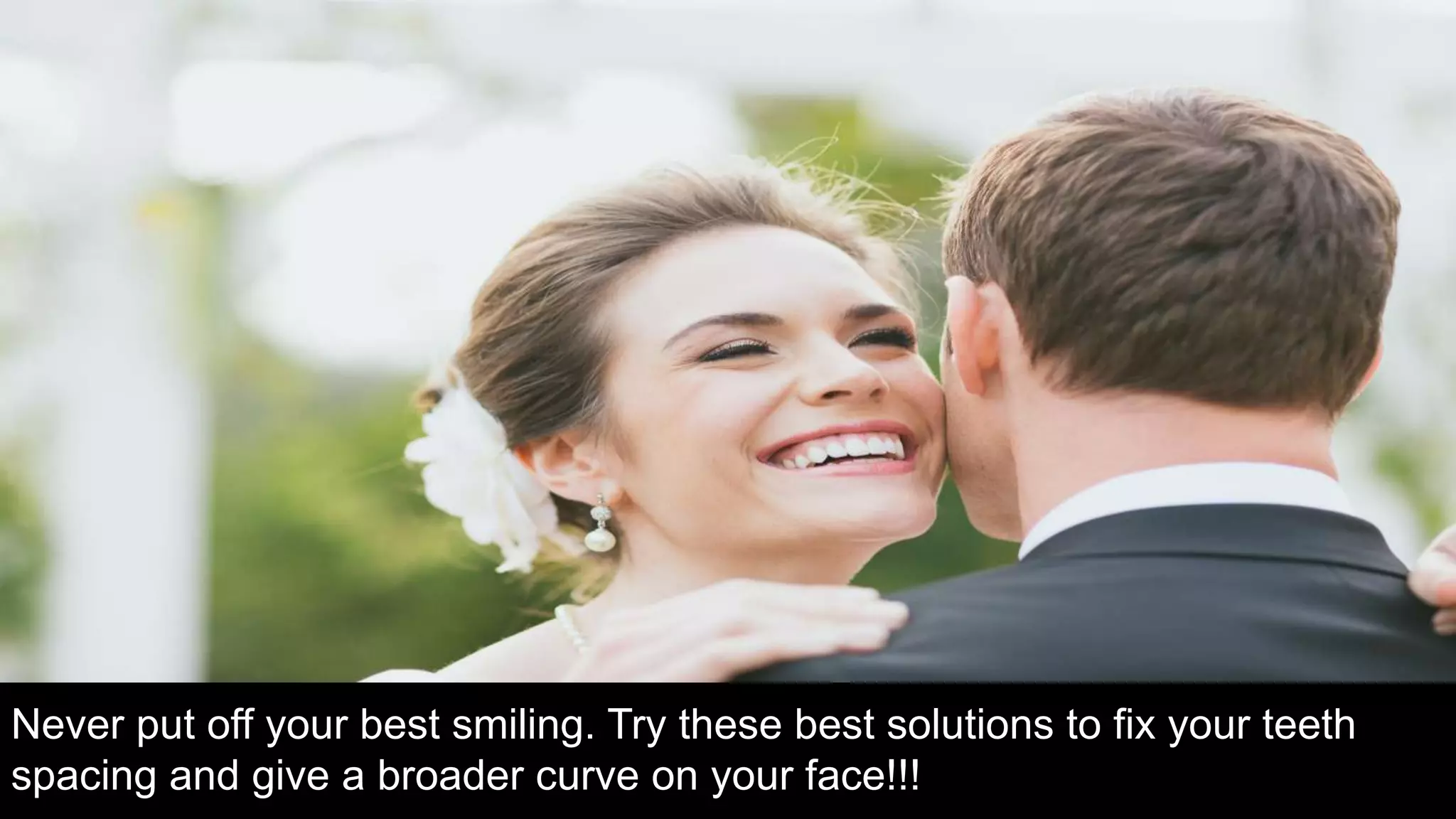 What is teeth spacing? – Its causes and cures | PPTX