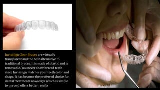 What is teeth spacing? – Its causes and cures | PPTX