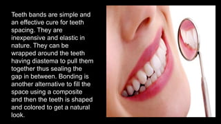 What is teeth spacing? – Its causes and cures | PPTX