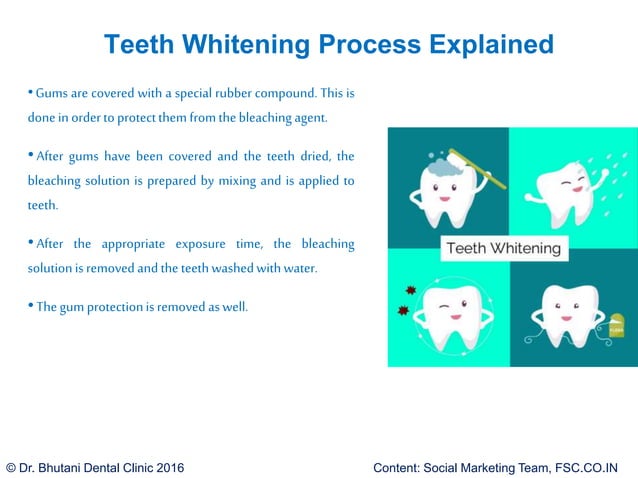 What Is The Process Of Teeth Whitening | PPTX | Dental Health ...