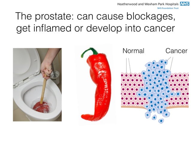 What is the prostate? | PPT