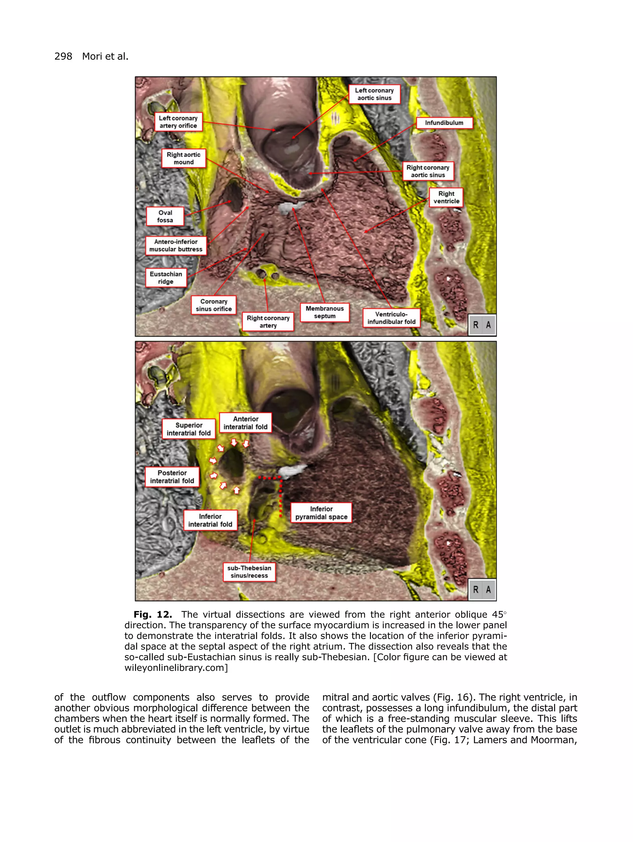 What is the real cardiac anatomy, clinical anatomy 2019 | PDF
