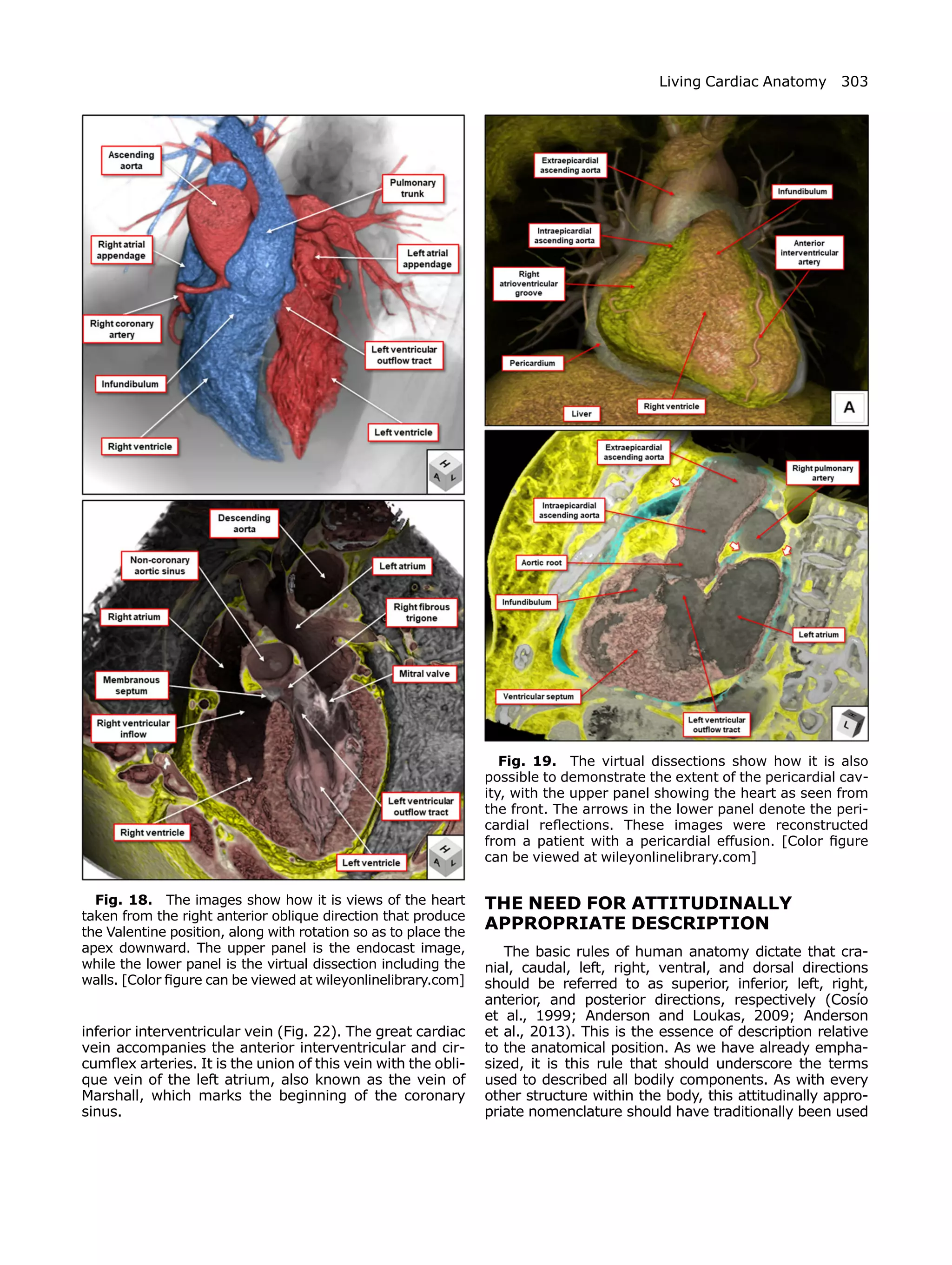 What is the real cardiac anatomy, clinical anatomy 2019 | PDF