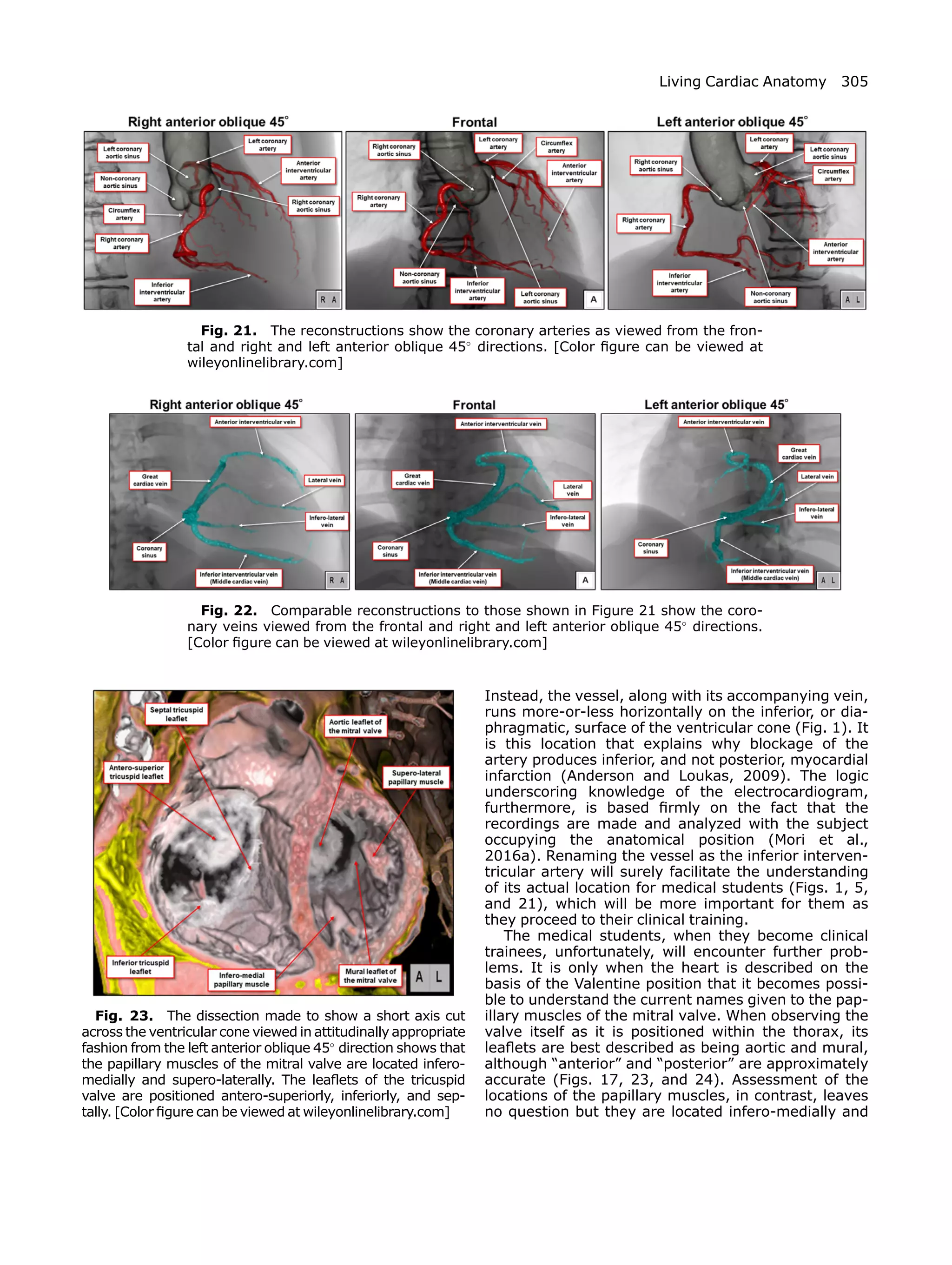 What is the real cardiac anatomy, clinical anatomy 2019 | PDF