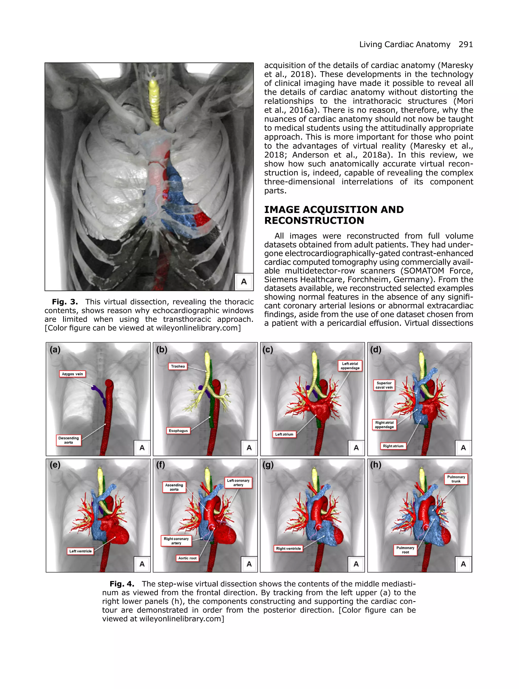 What is the real cardiac anatomy, clinical anatomy 2019 | PDF