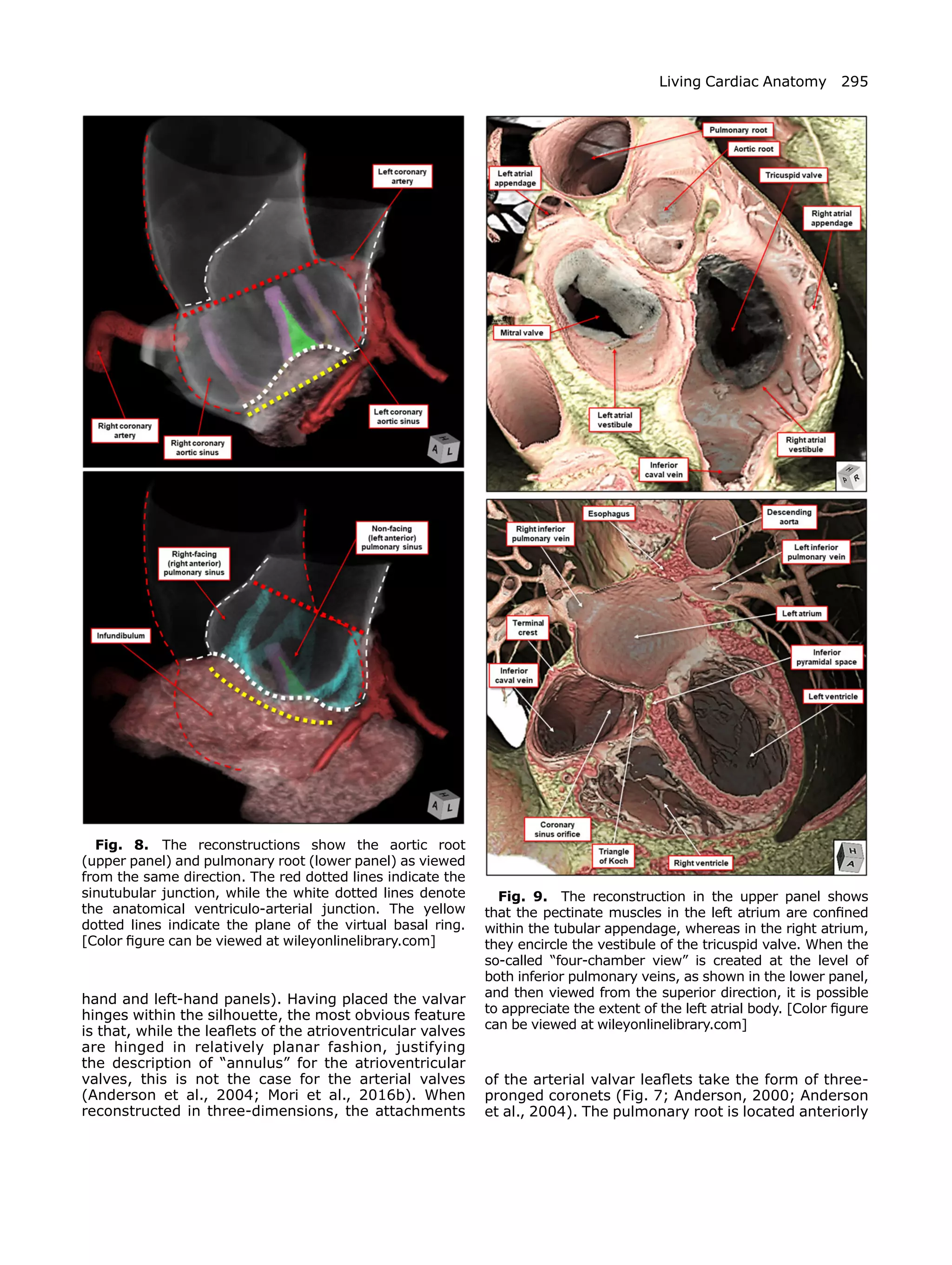 What is the real cardiac anatomy, clinical anatomy 2019 | PDF