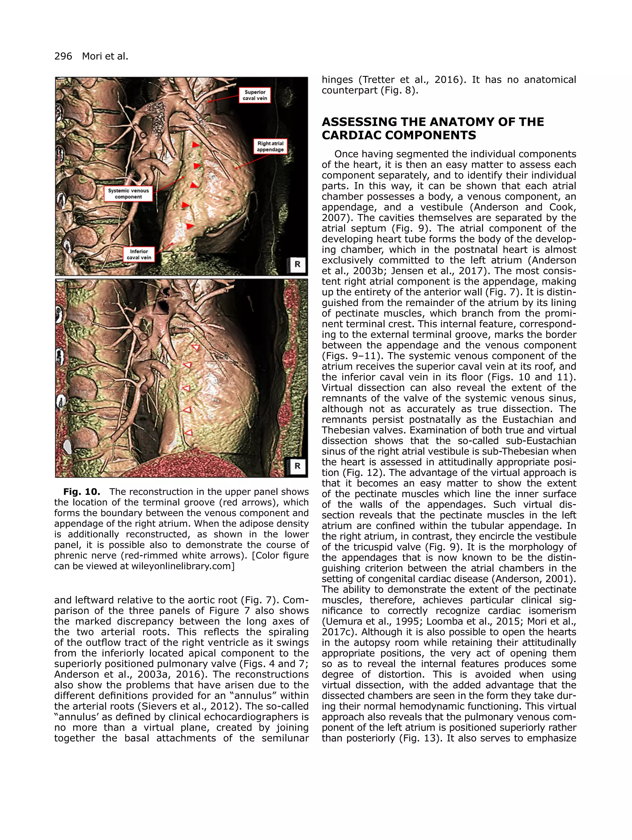 What is the real cardiac anatomy, clinical anatomy 2019 | PDF