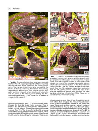 What is the real cardiac anatomy, clinical anatomy 2019 | PDF