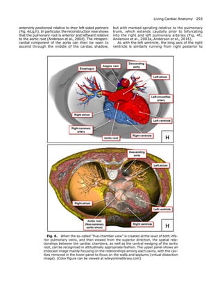 What is the real cardiac anatomy, clinical anatomy 2019 | PDF