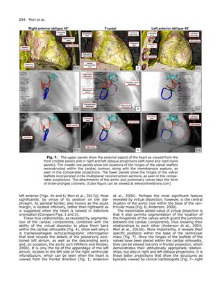 What is the real cardiac anatomy, clinical anatomy 2019 | PDF