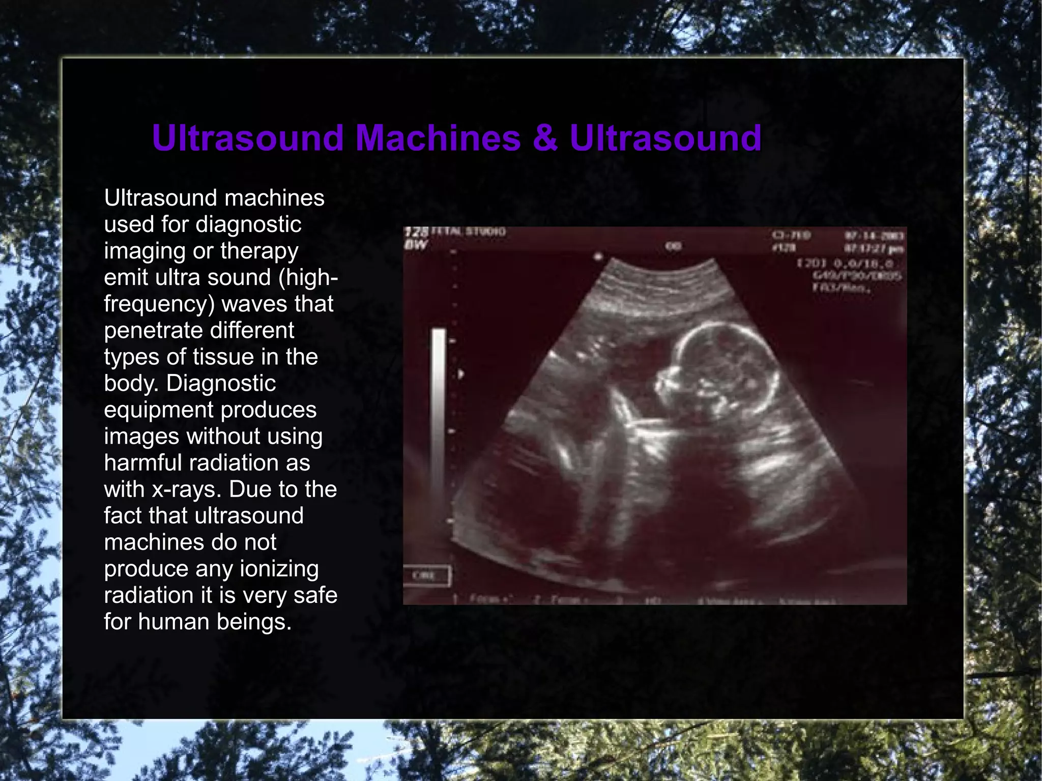 What is ultrasound | PDF