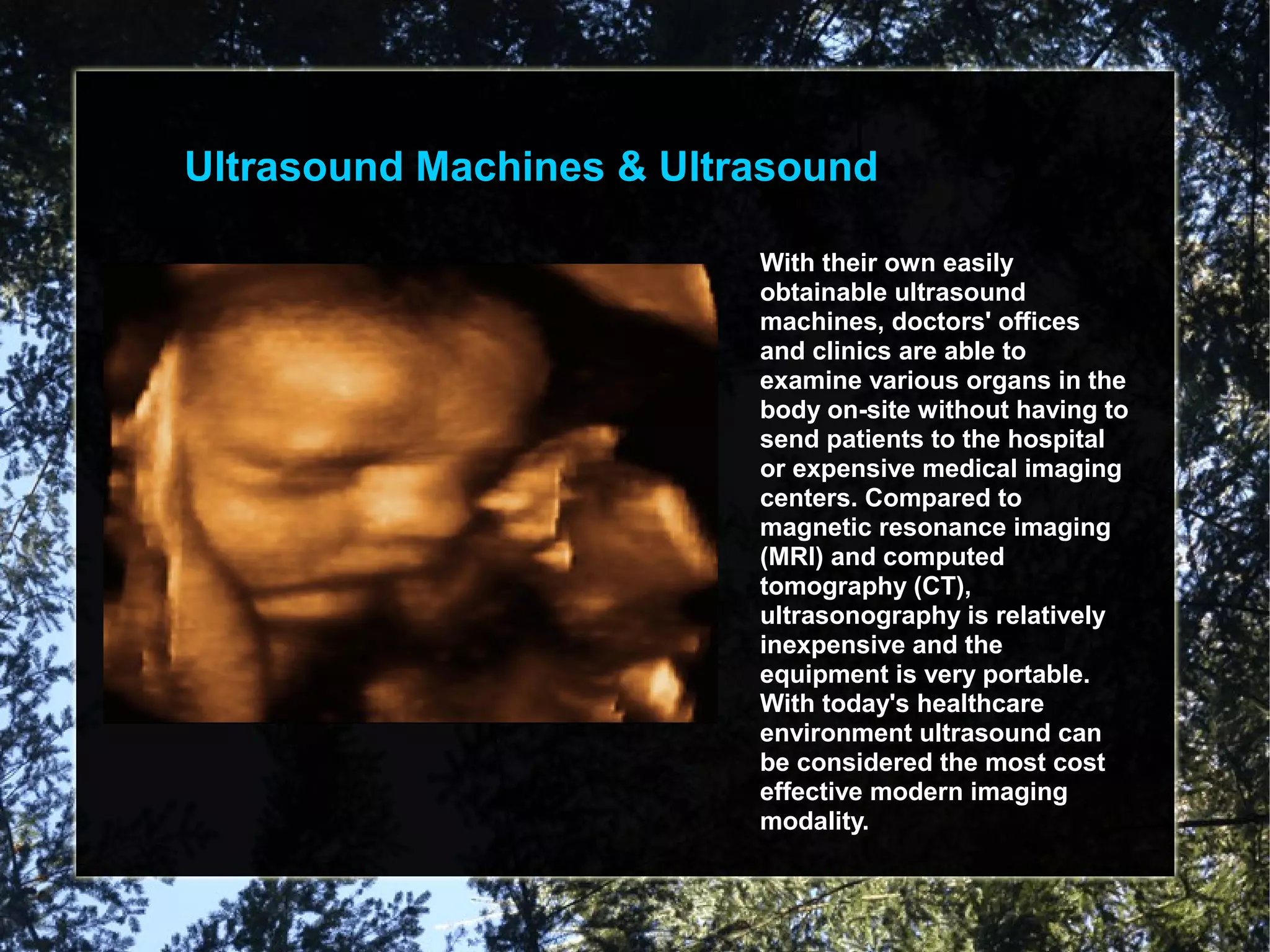 What is ultrasound | PDF