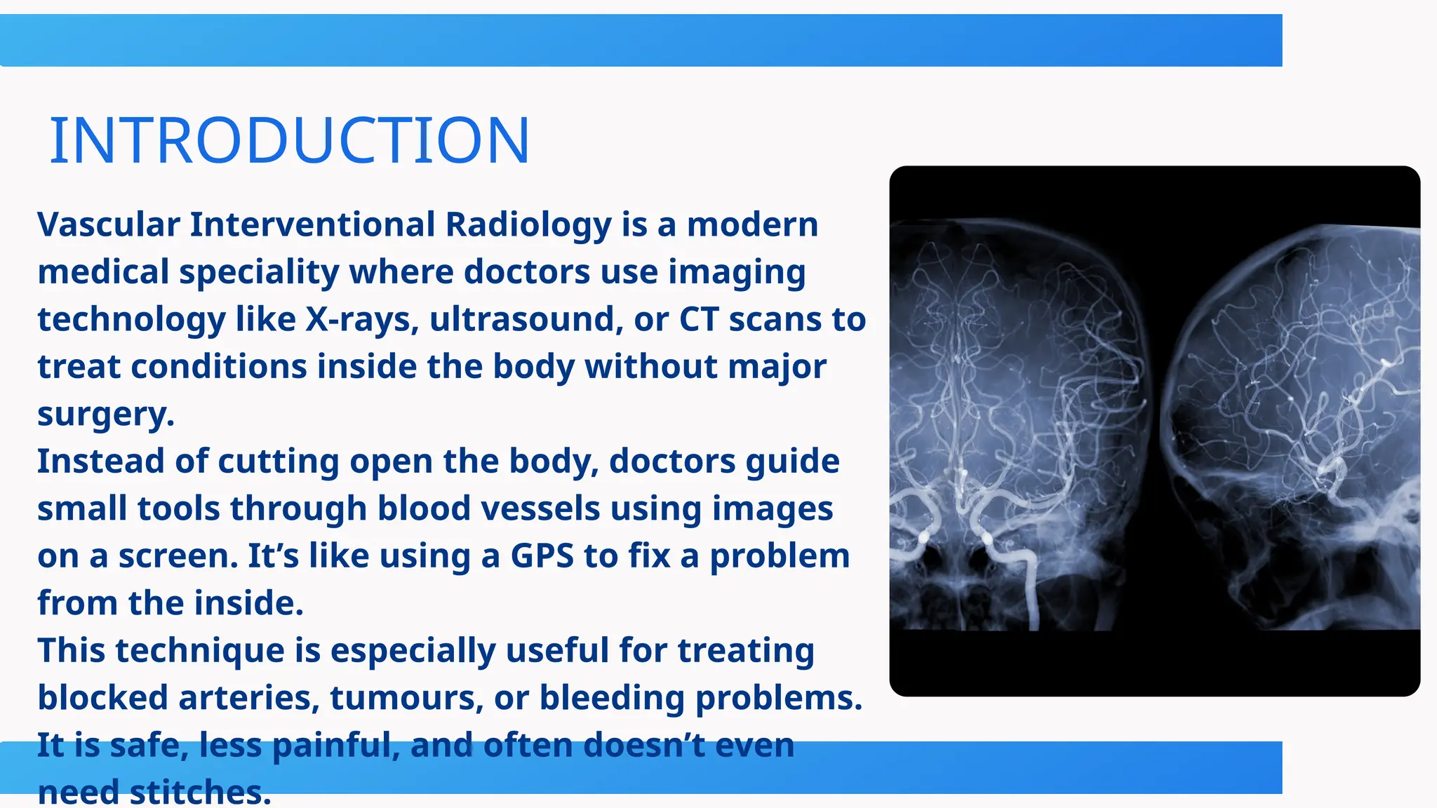 What Is Vascular Interventional Radiology And How Does It Work | PPTX