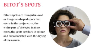 What Is Vitamin A Deficiency? | PDF