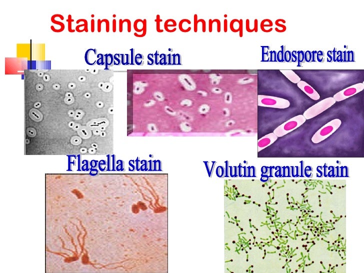 What Makes Microbiology Interesting