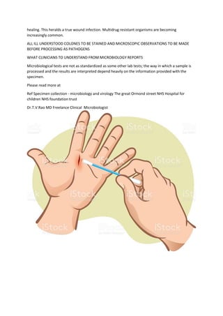 What microbiologists and clinicians should know about culturing wound ...