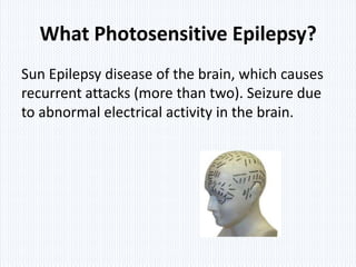 What photosensitive epilepsy | PPTX