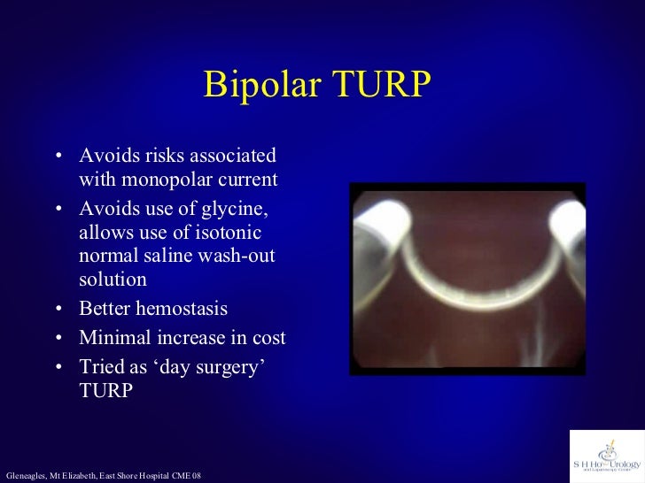 What is New In Minimally Invasive Surgery for Urology